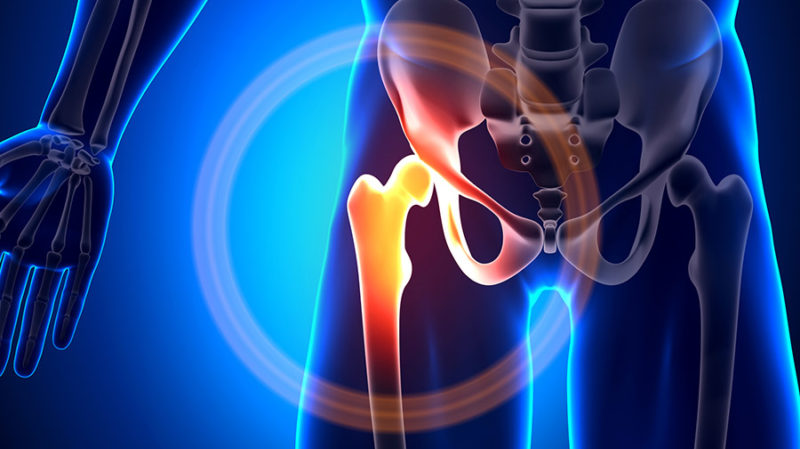Spierpijn bovenbeen: met deze methodes kom je er snel vanaf ...
